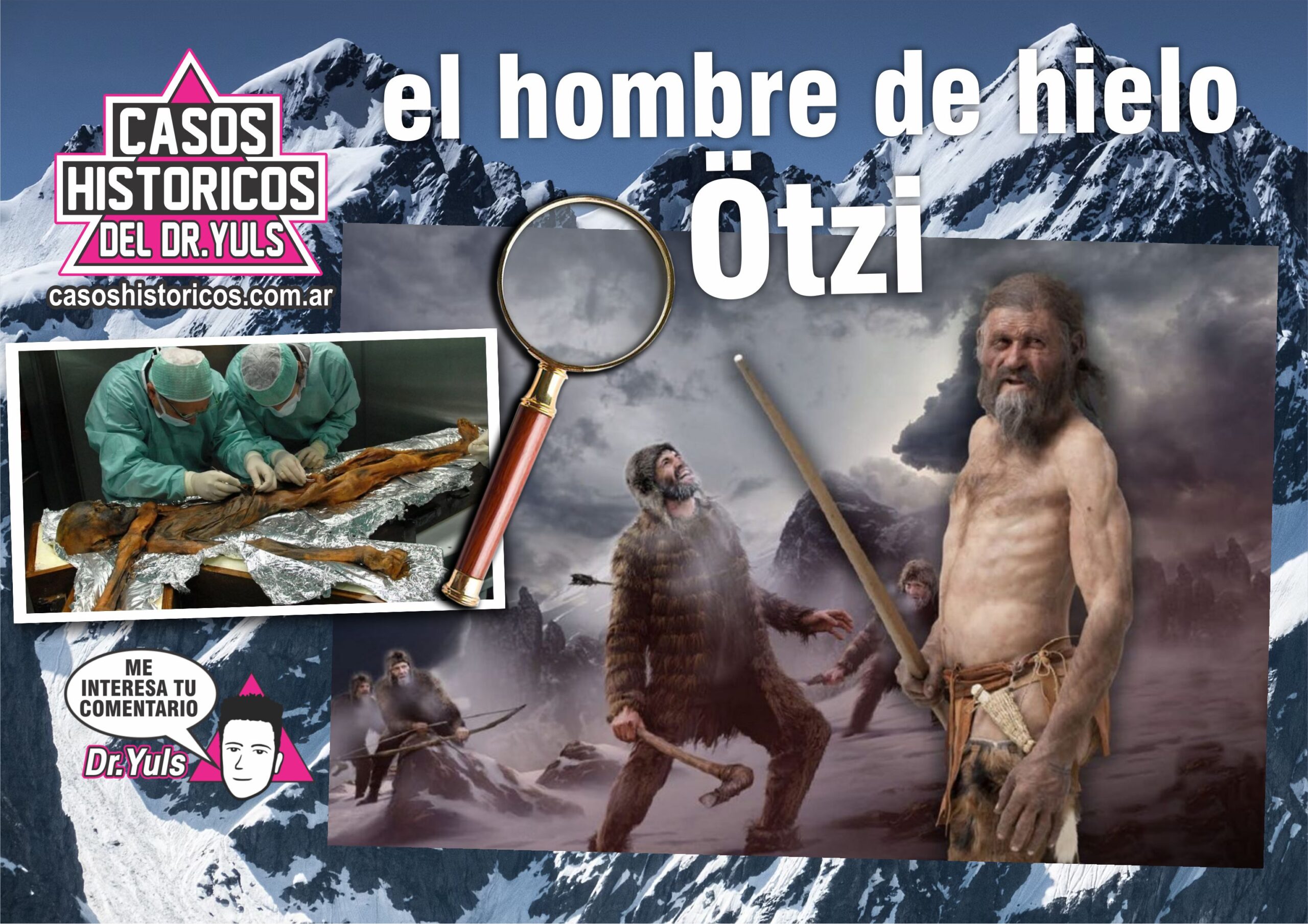 Ötzi, el Hombre de Hielo